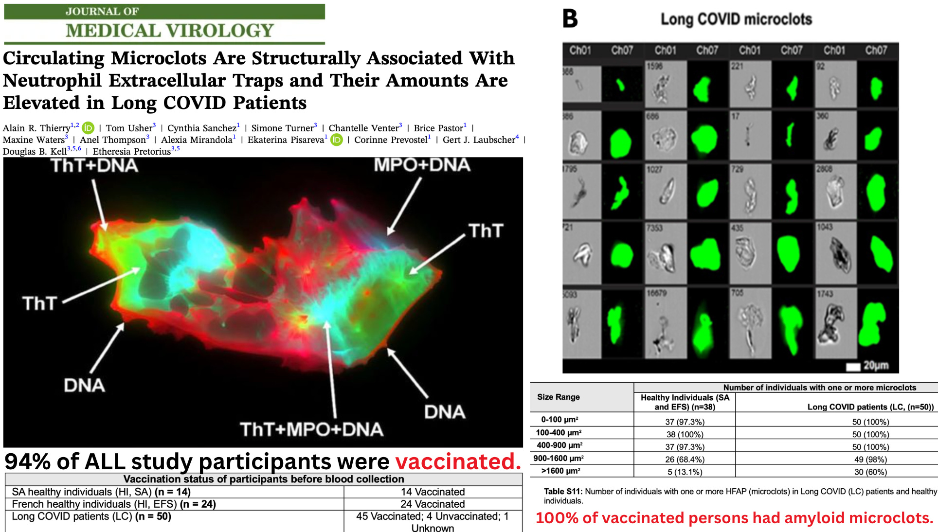 graviolateam finland: Anomalous Amyloid Microclots Found in 100% of the ...