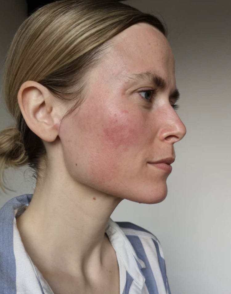 Is toner actually necessary? - Natalie O’Neill