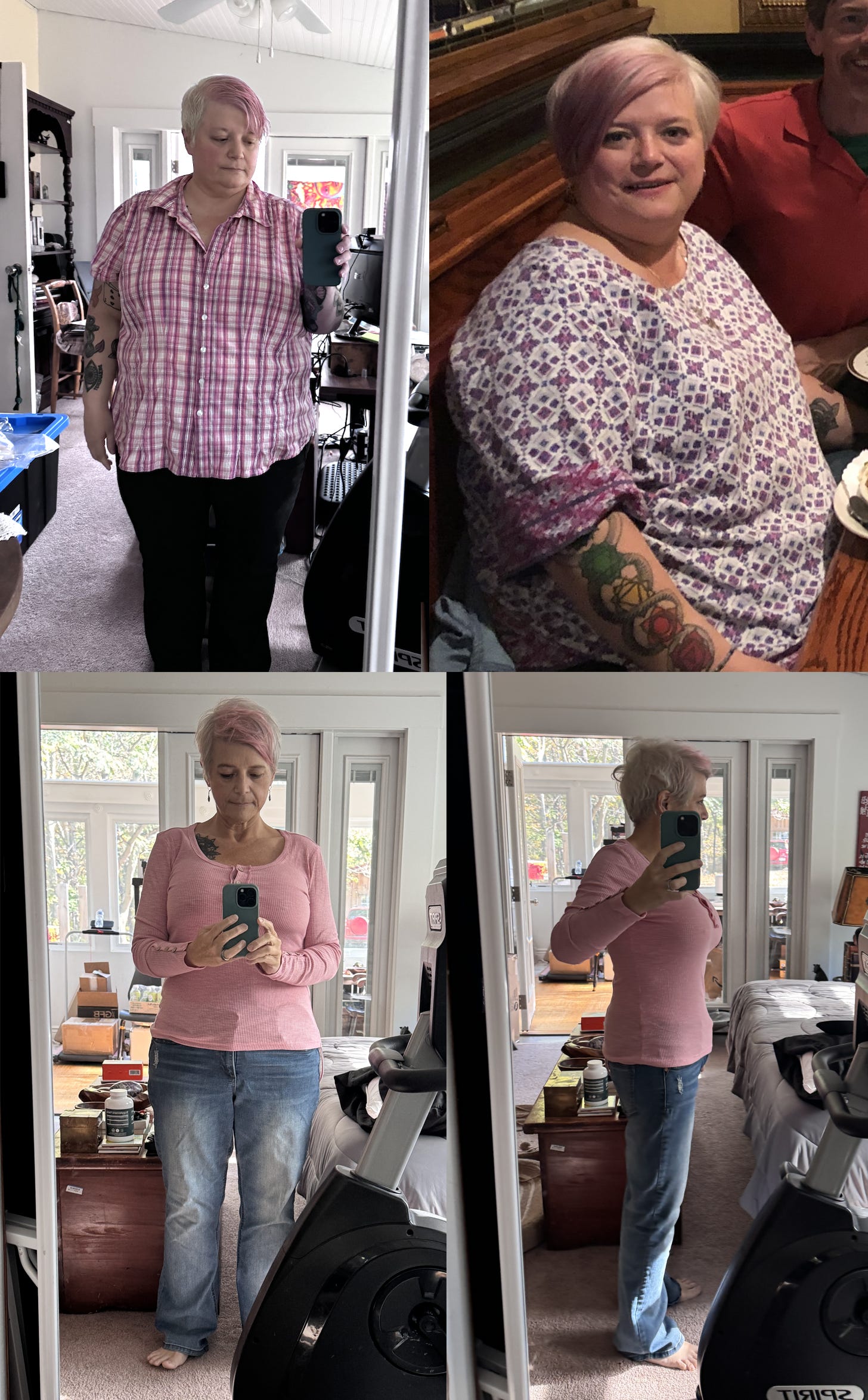 From 260 lbs to Peptides, Surgery, and Maintenance: My Full Story