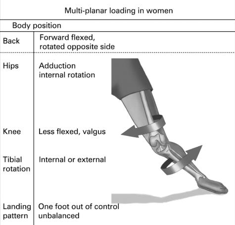 The ACL, Explained: How One Small Ligament Keeps Your Knee From Coming ...