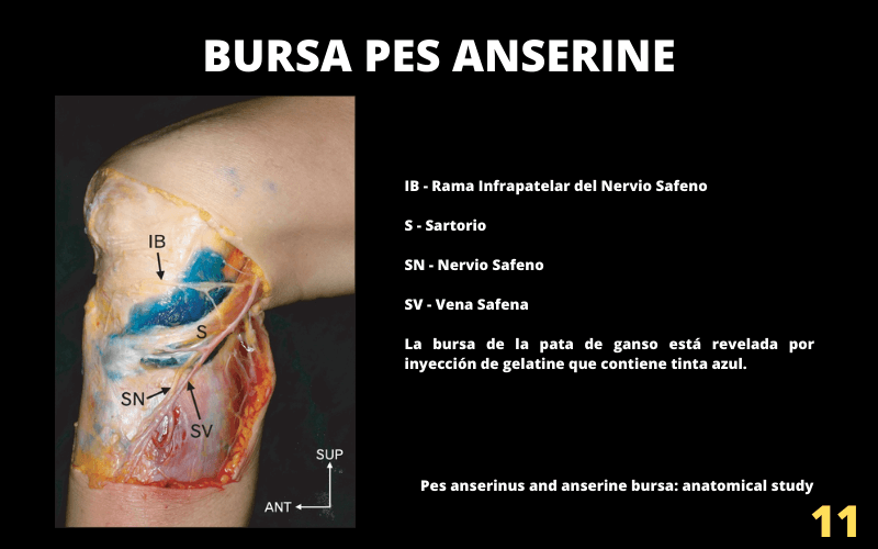 Bursas y ecografía - Rodilla - by Tempo Formación
