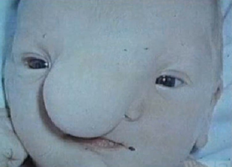 The Profile Original: Meet Robert Hoge, the ‘Ugly’ Human Living a ...