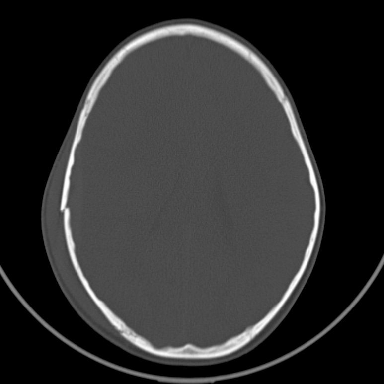 CT windows and levels - by Alexander Baxter - RadNotes