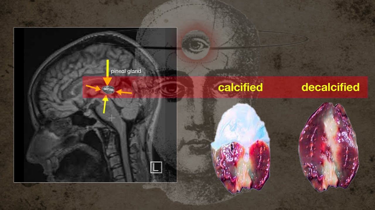 The Stone in Your Brain: How Modern Life Is Calcifying Your Pineal ...