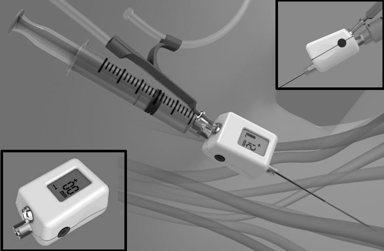 A new way to measure pressure during central venous access