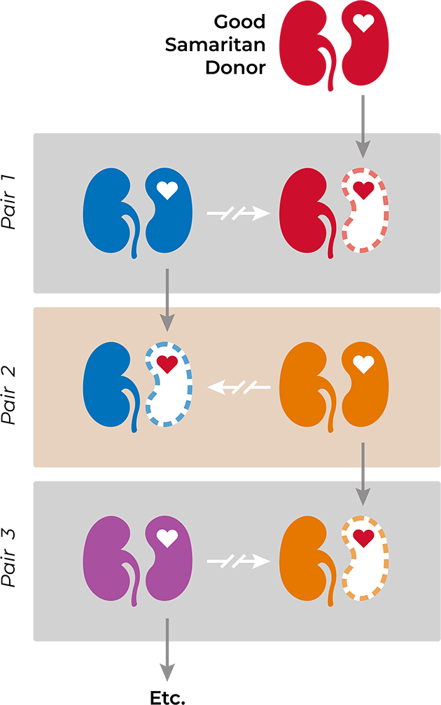 My kidney donation story - by Molly Hickman - Cutty Shark
