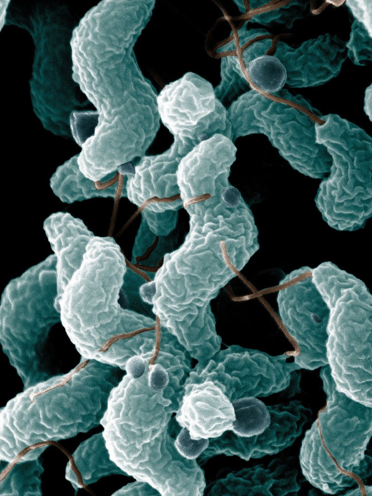 A Visual Journey through Bacterial Morphology: Understanding Microbial ...