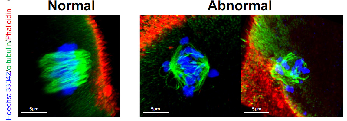 Cannabis and Assisted Reproductive Technology (ART)