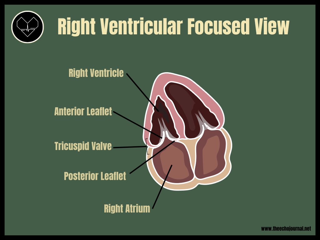 Tricuspid Leaflets Made Simple - The Echo Journal