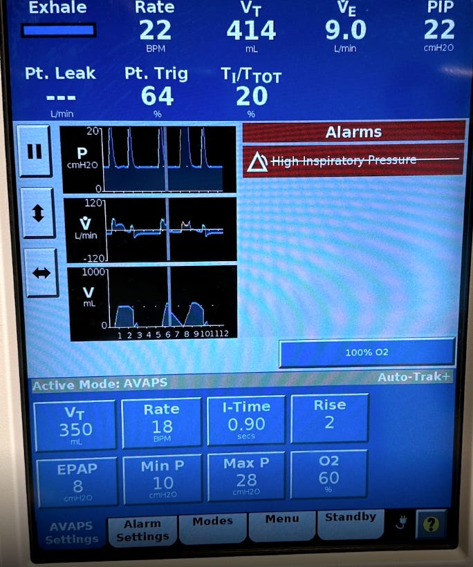 CPAP, BiPAP, AVAPS, HFNC – Which One Does Your Patient Need?