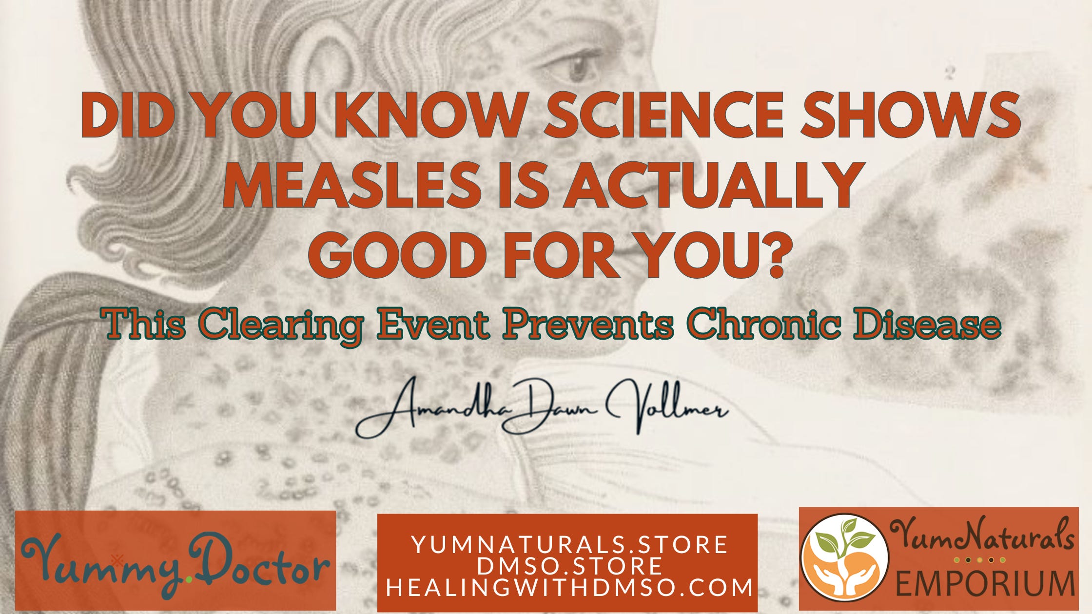 DID YOU KNOW SCIENCE SHOWS MEASLES IS ACTUALLY GOOD FOR YOU?