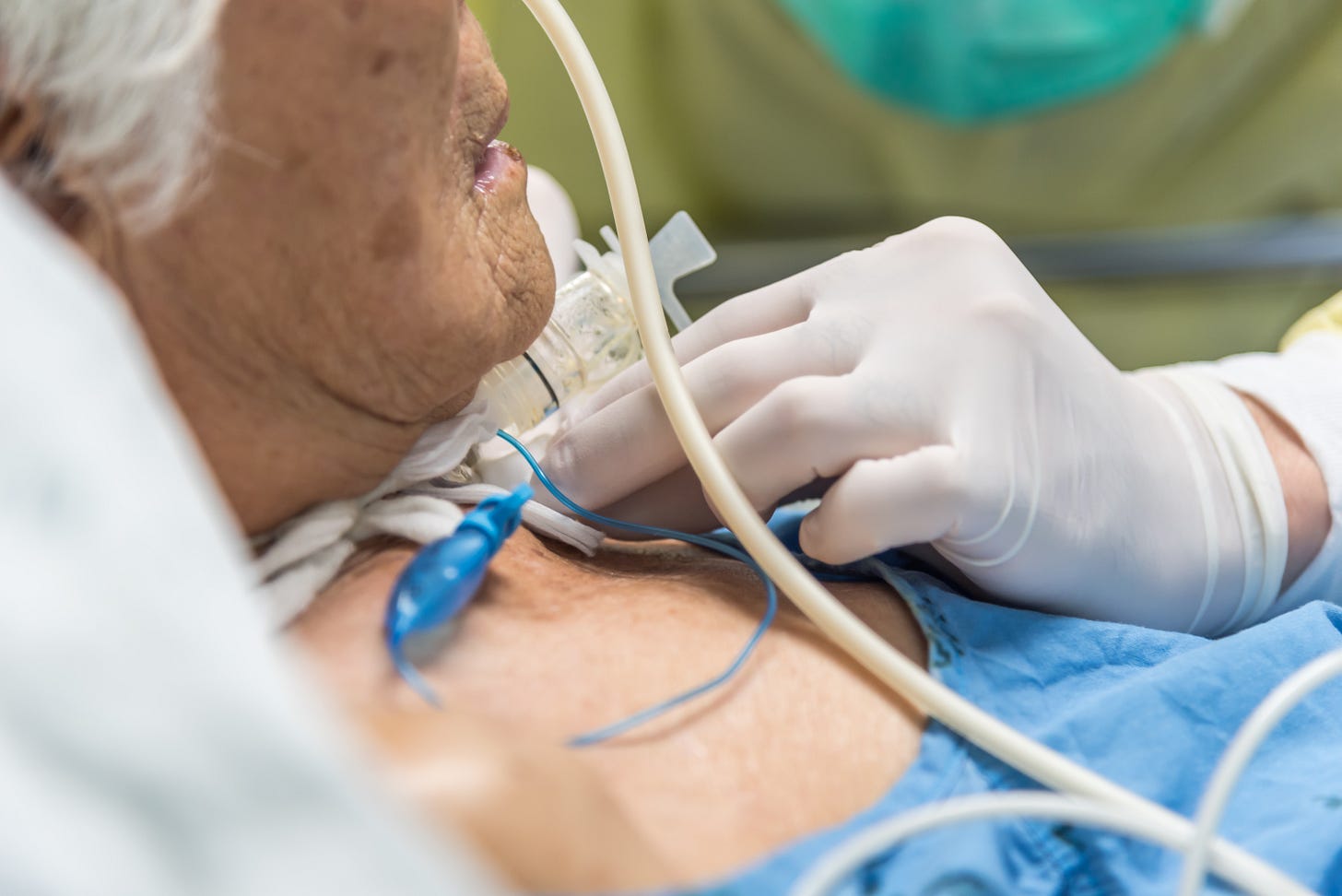 The Latest In Critical Care: June 5, 2025 - PulmCCM