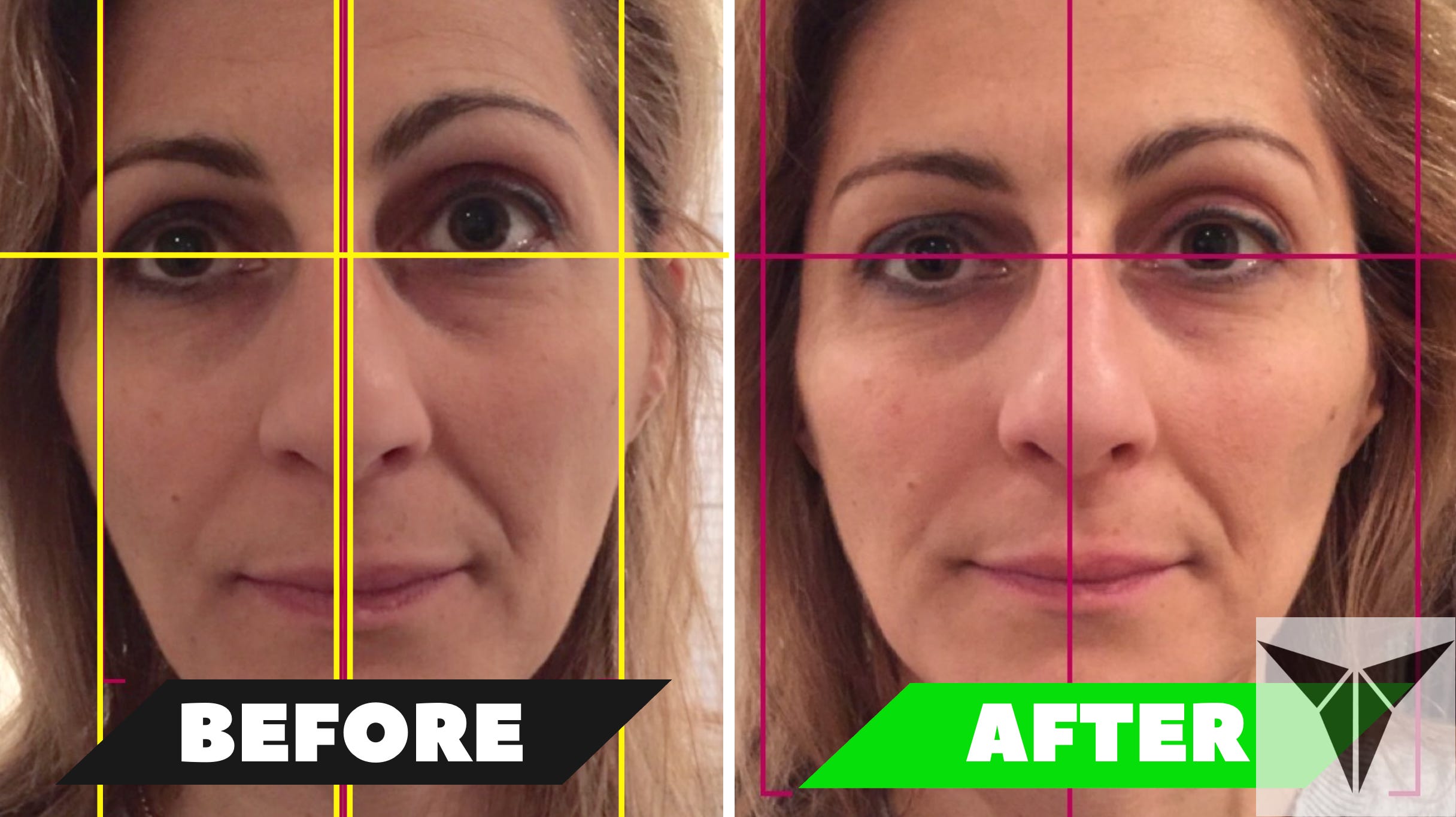 Strengthen your jaw, improve tongue posture, and fix facial imbalance ...