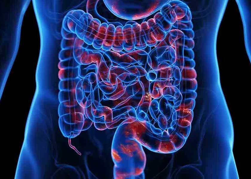 Toxic Chemicals in Food and Water Disrupt Your Gut Microbiome and Fuel ...