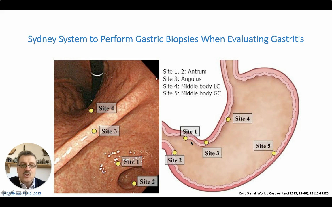 Sydney Protocol for Stomach Biopsies