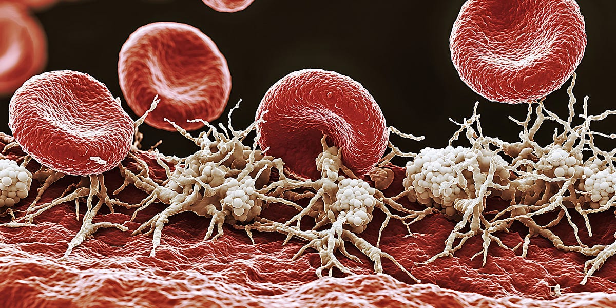 Thromboelastography (TEG/ROTEM™) for bleeding: Review (Part 2: Evidence ...