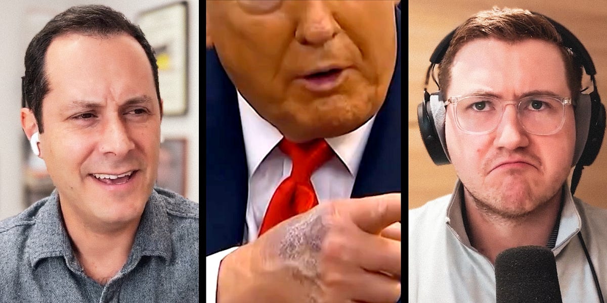 Does Trump’s Bruised Hand Story Make Sense?