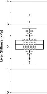 Plunger Plots and Why to Avoid Them