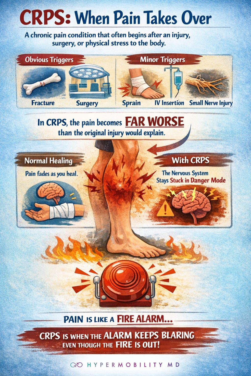 Complex Regional Pain Syndrome (CRPS):