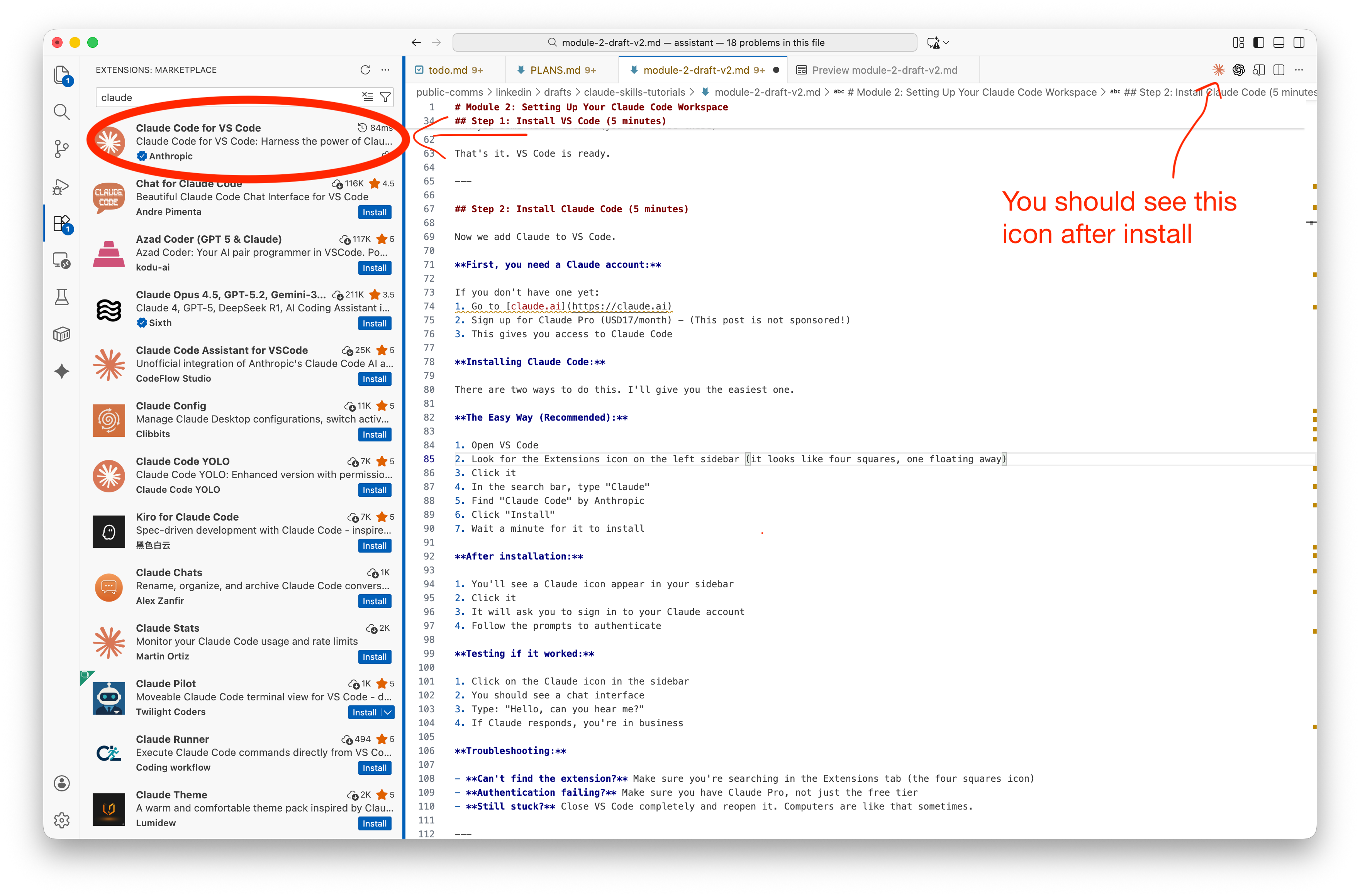 ⚙️ A Practical Guide to Setting Up Claude Code (No Coding Required)