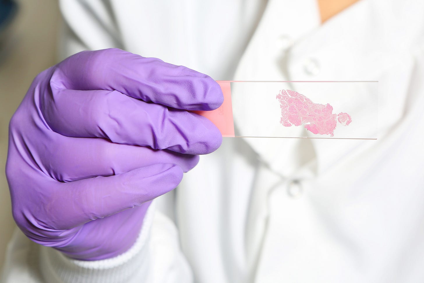 Duavee Shows Promise in Breast Cancer Study