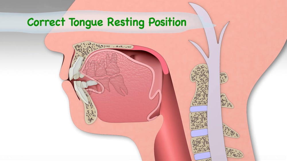 Mastering Proper Tongue Posture: A Guide for Improved Breathing and Posture