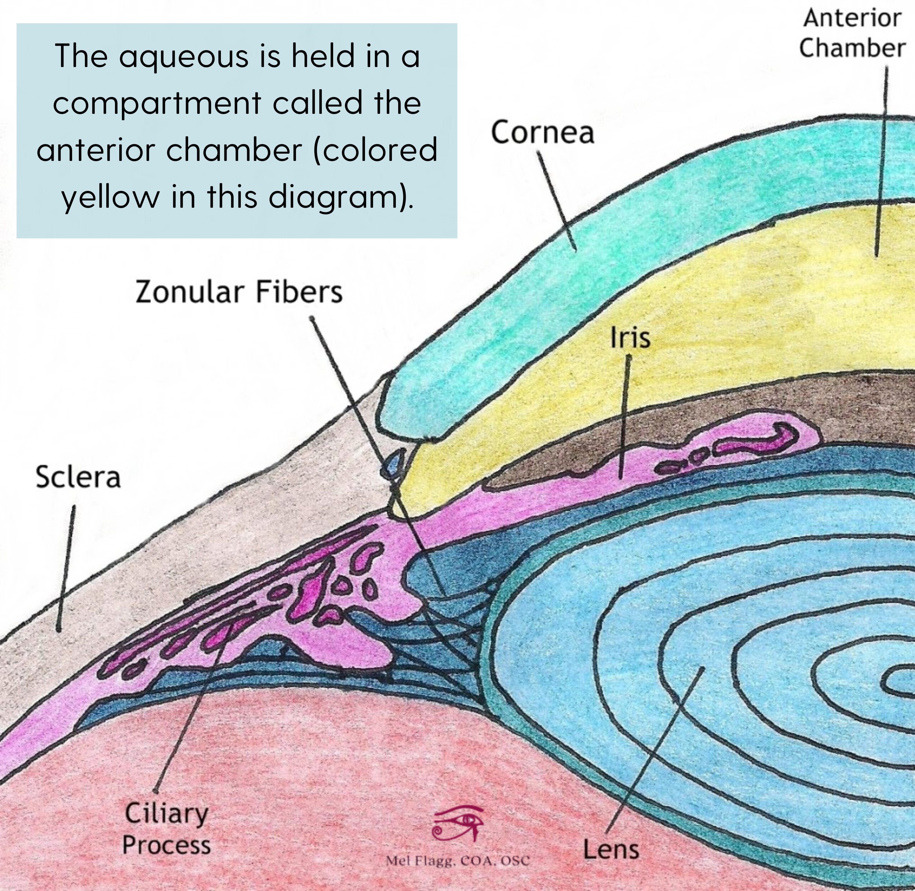 Narrow Angle Glaucoma: Causes, Symptoms, and Treatments