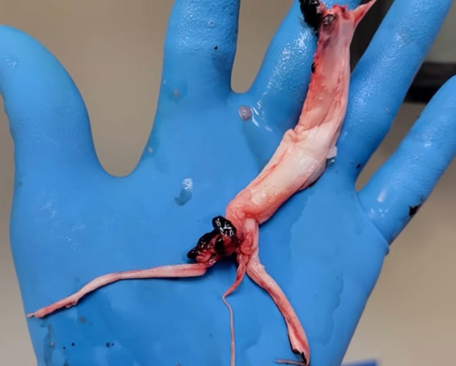 APM - Michael Merrick