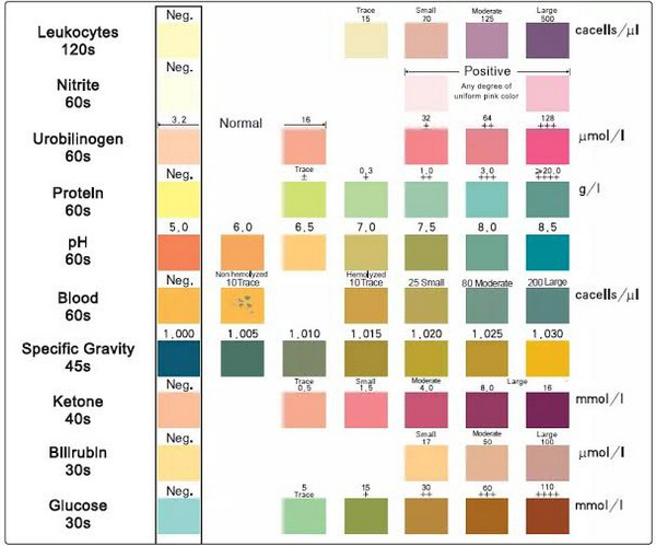 How to interpret a urine dipstick result