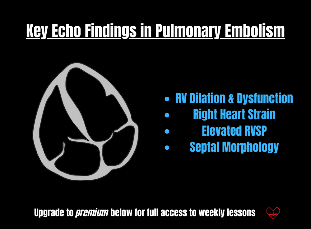 Pulmonary Embolism: Types, Case Studies, and the Role of Echocardiography