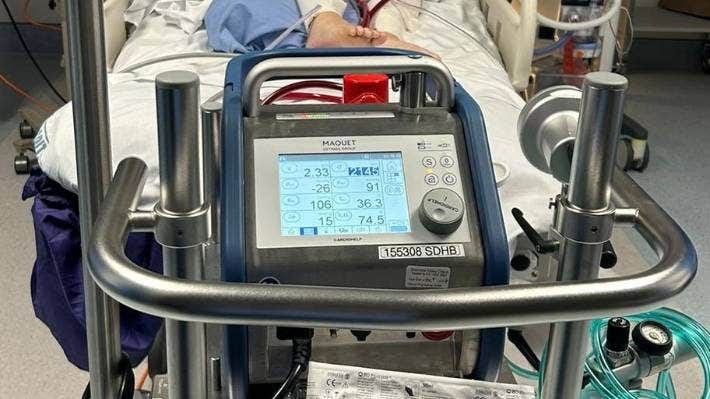 What Is ECMO? - by Jonathan Jung