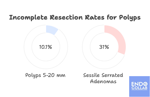 Mastering Colon Polypectomy: Key Principles for Complete R0 Resection.