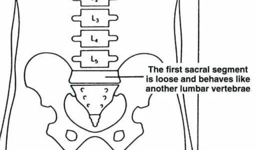 sacralization causes