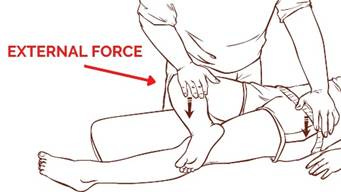 Clinician’s Corner: Differentiating Hip Joint, SIJ, and Lumbar Spine Pain