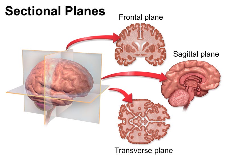 A Journey Through Neuroanatomy: Navigating the Brain