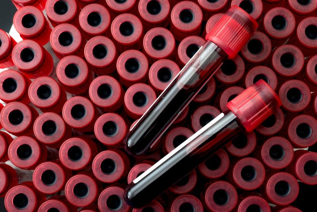 We Need to Talk About Red Tubes