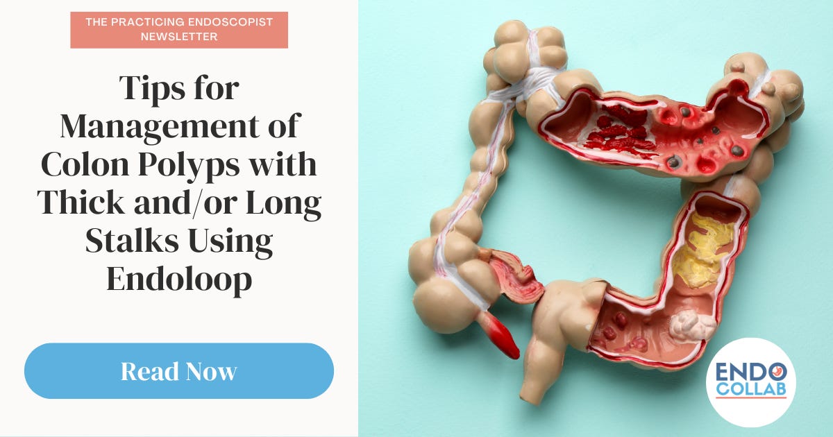 Tips for Management of Colon Polyps with Thick and/or Long Stalks Using ...