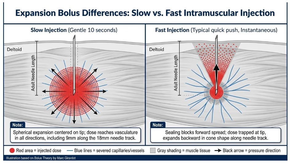 Templeton Times: Fast Injections = Massive IV Leak: What 10,000 ...