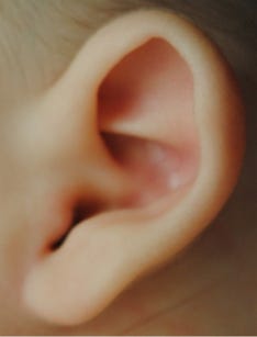 Pediatric Pearls: Infant's Ear - Pits, Tags, and the Pinna