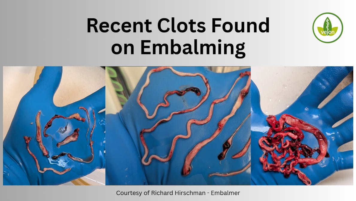 Latest Embalmer Insights - What's Changing in the CLOT Findings?