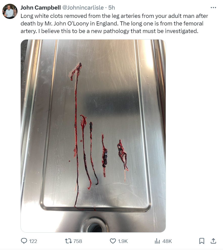 The Now Ubiquitous and Fatal White Clots: A Prion Disease of the Blood?