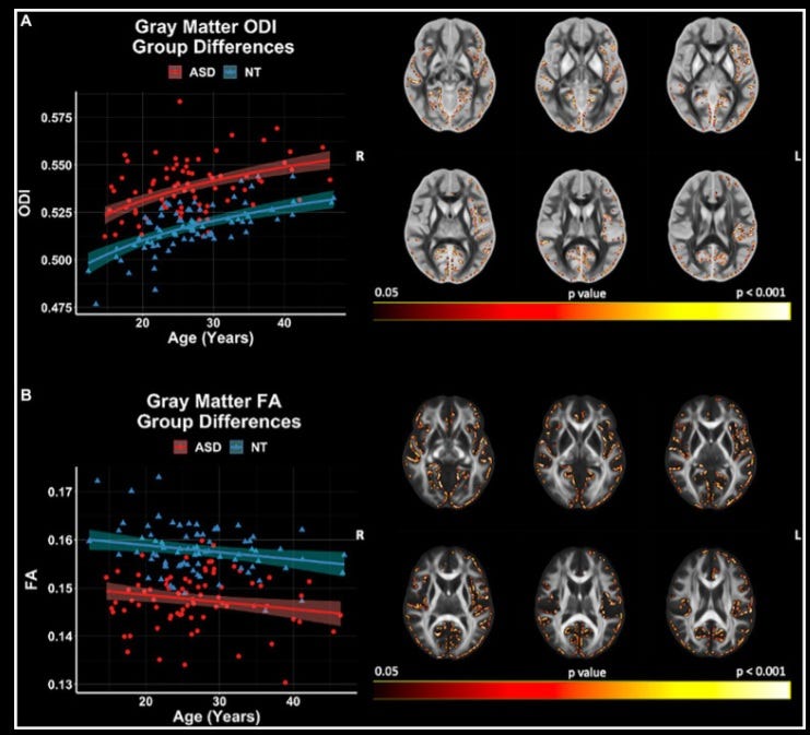 Are Autistic Brains Different From Neurotypical Brains?