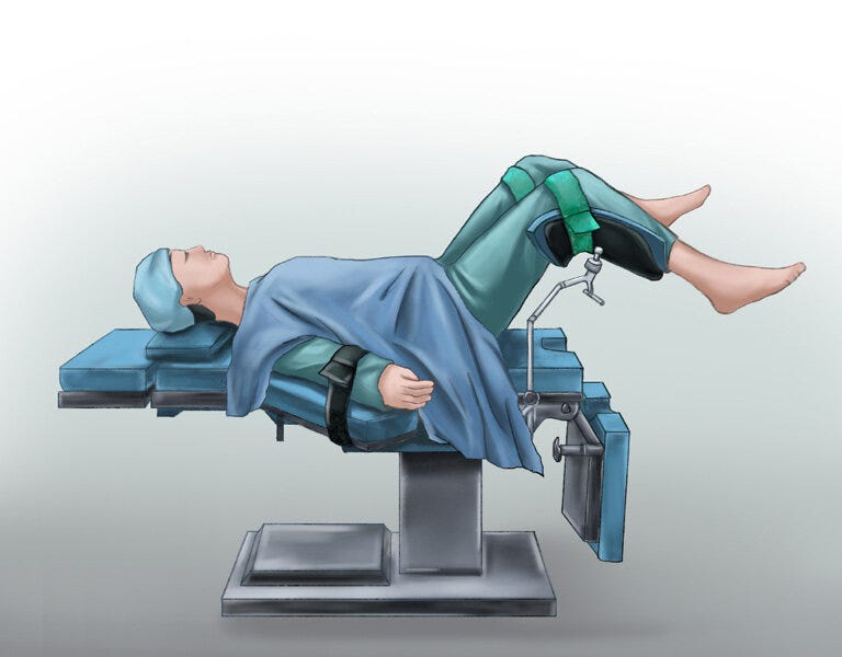 lithotomy position types