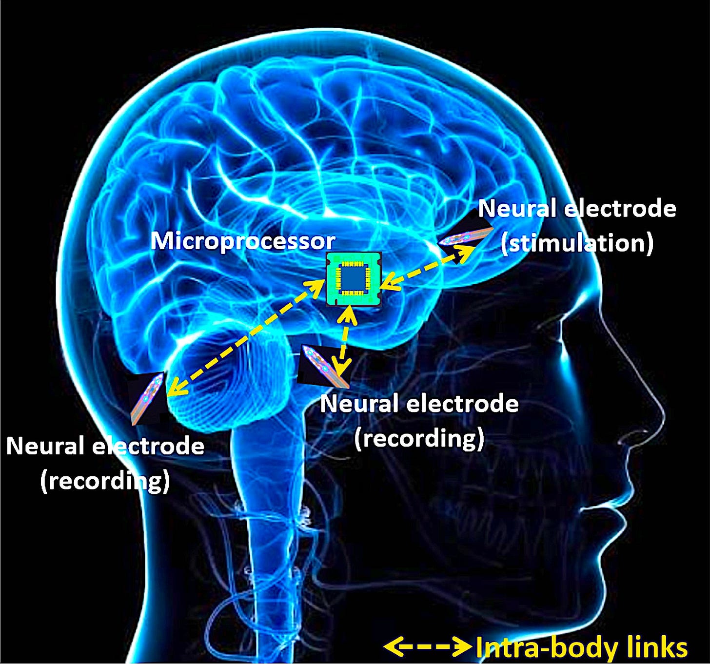 Sabrina Wallace: Your Cells Are the Chip
