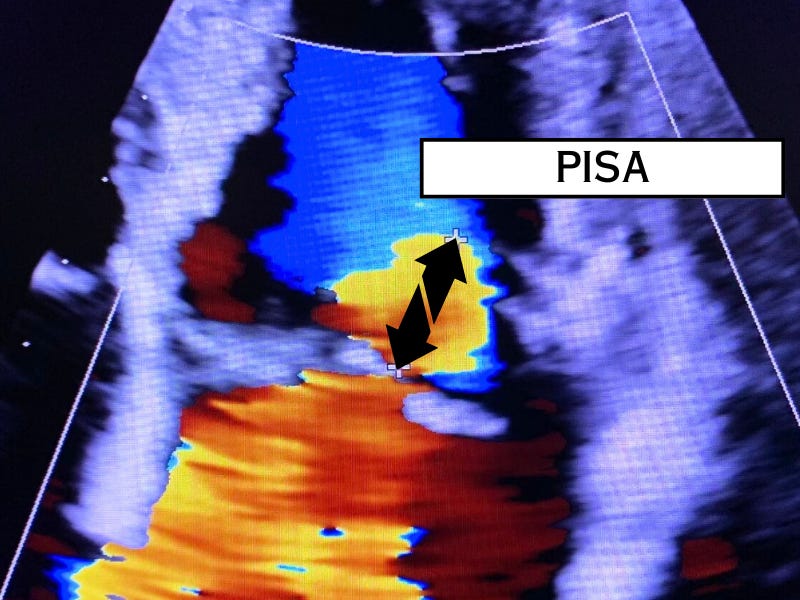 Who is PISA? - The Echo Journal