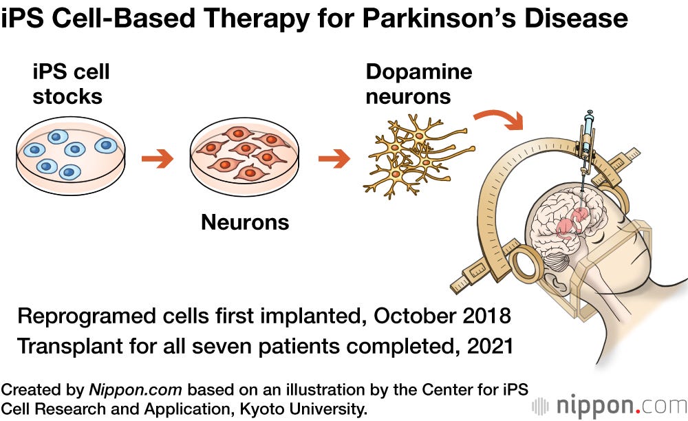 Japan Just Approved the Future: iPSC Therapy Has Officially Arrived