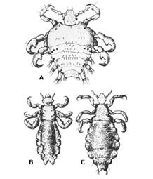 Lice (and How to Deal with Them)