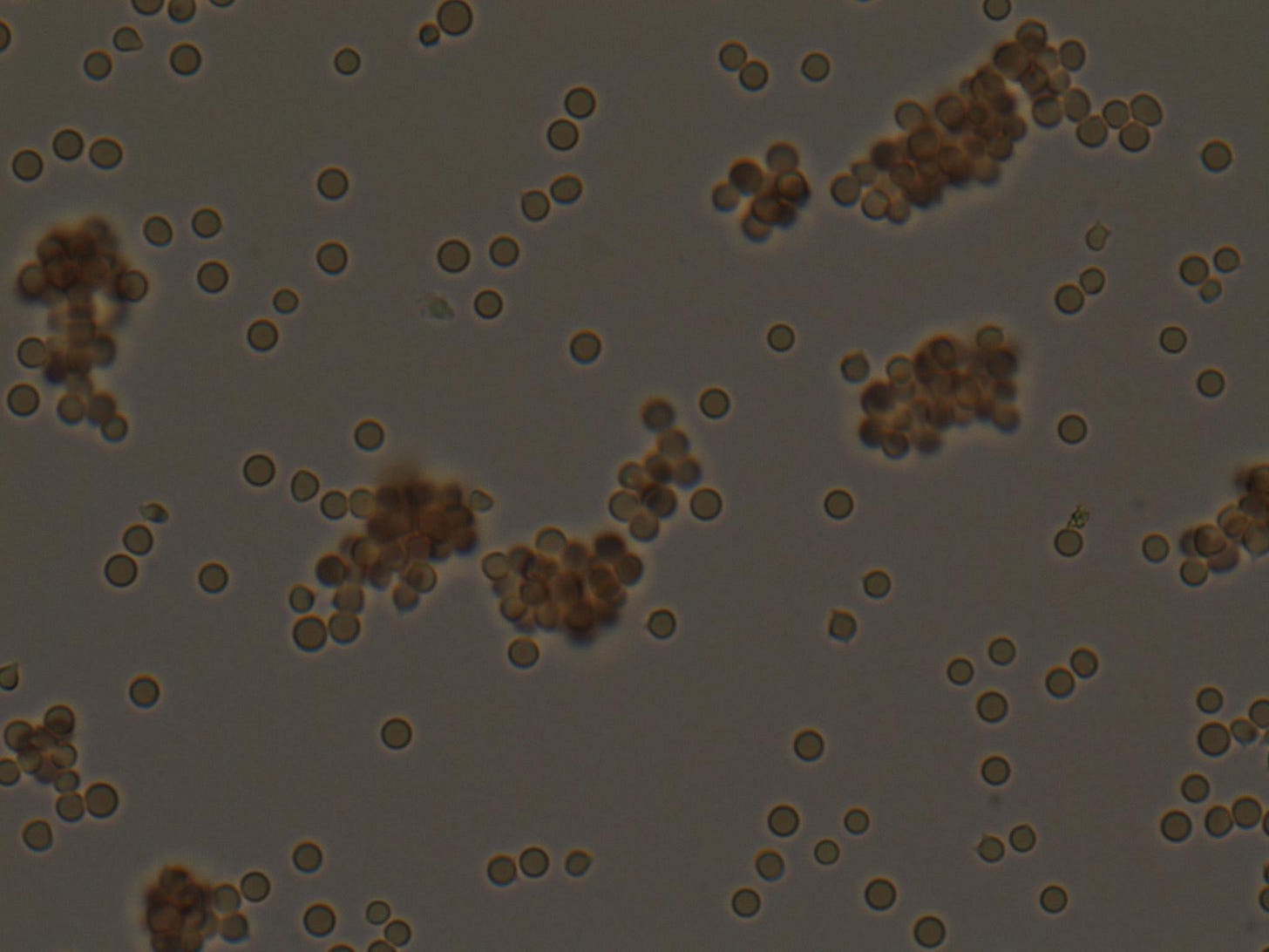 What's the Deal with the Saline "Agglutination" Test?
