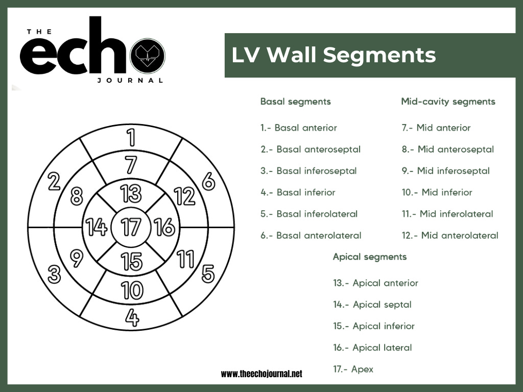 Wall Motion Isn’t Guesswork - by Alex C. - The Echo Journal