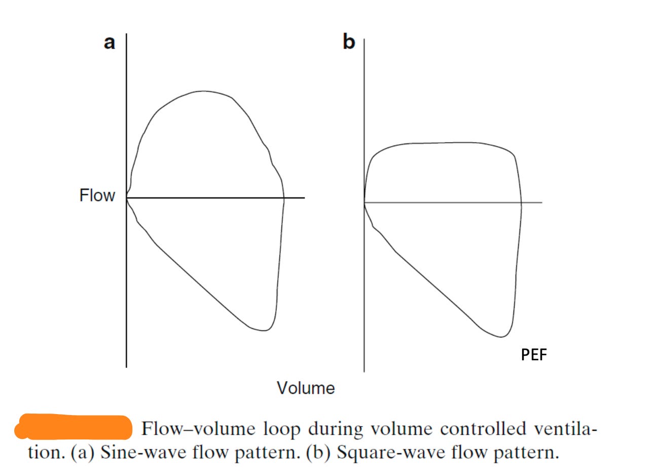 The Ventilator Screen Decoded — Part 2